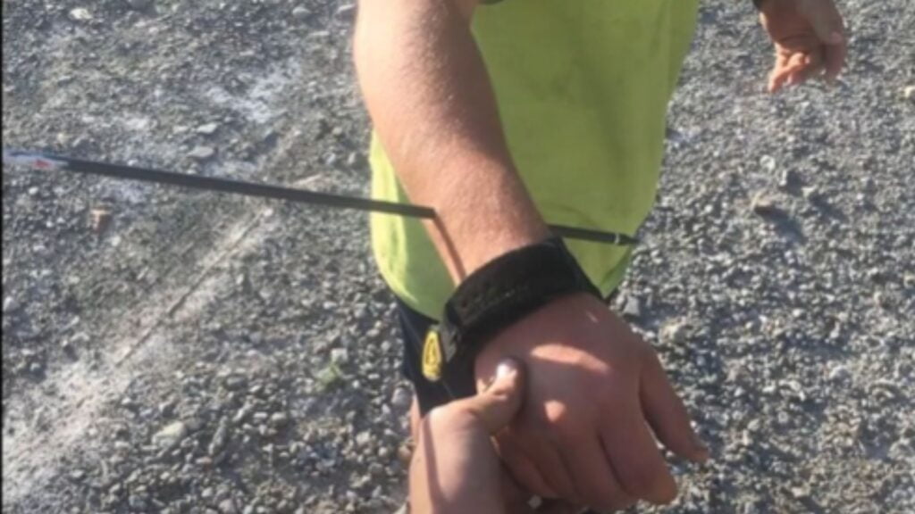 Carbon Fiber Arrow Injury: Dangers and Consequences